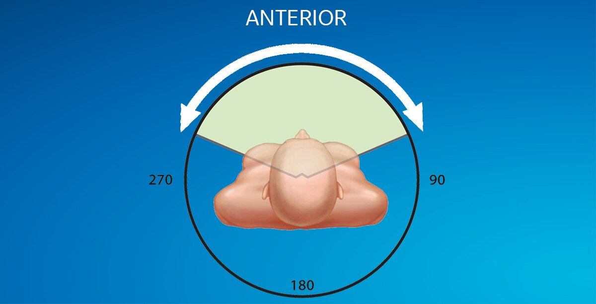 Семейство Optima CT | GE Healthcare