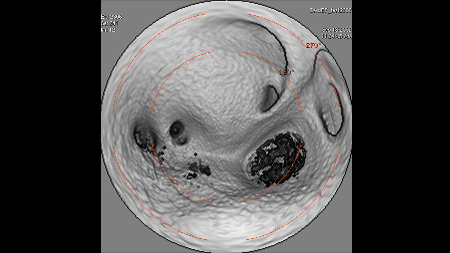 CardEP | GE Healthcare