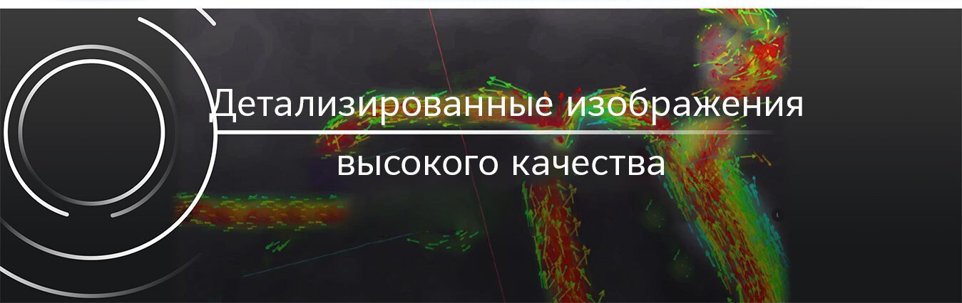 SIGNA Premier — 70 см | GE Healthcare (Russia)