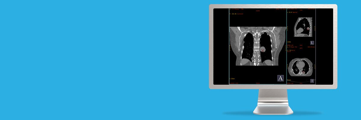 Advantage 4D | GE Healthcare (Russia)