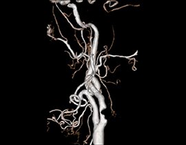 Innova 3D | GE HealthCare (Russia)