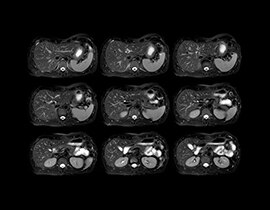 PROPELLER | GE HealthCare (Russia)