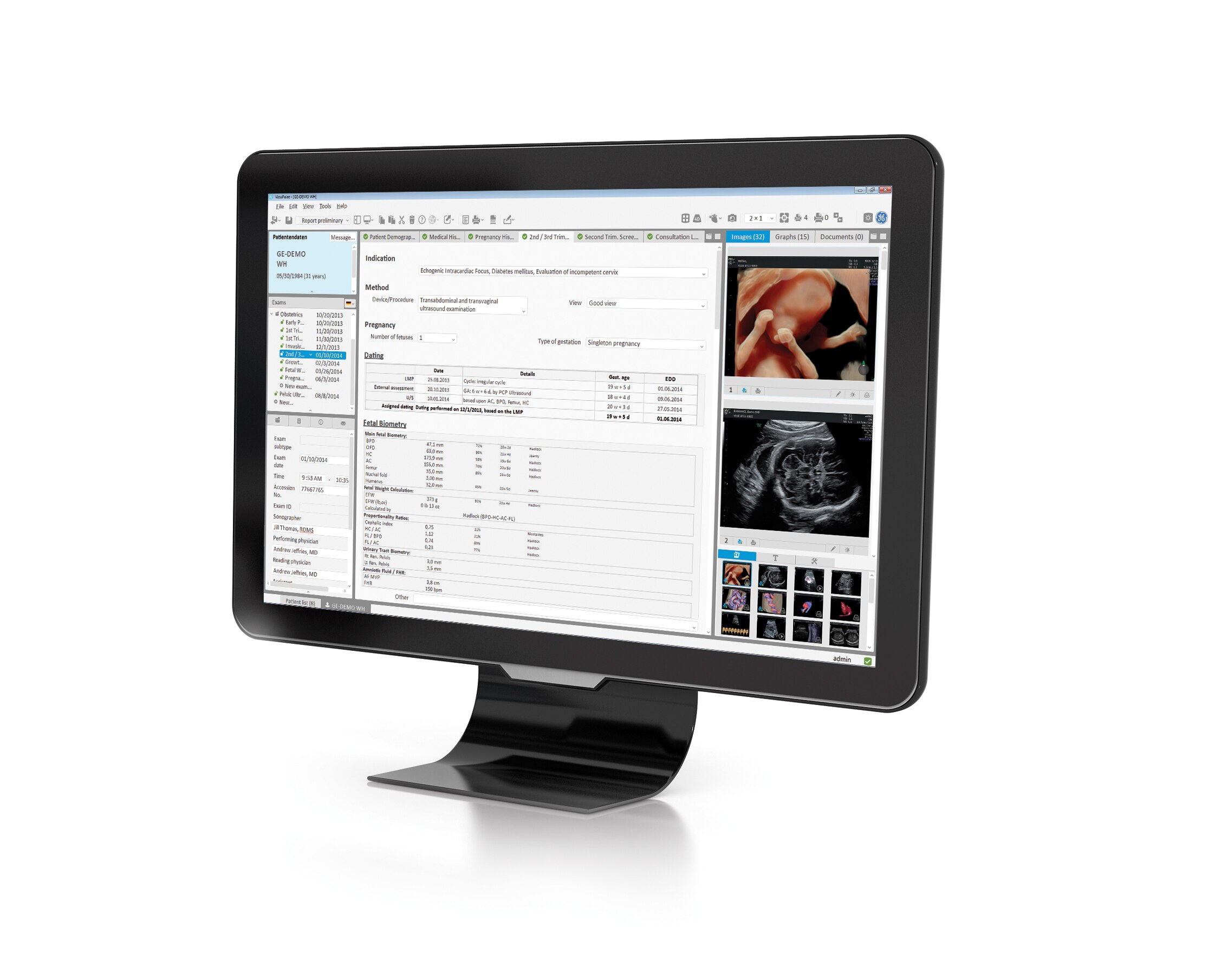 ViewPoint 6 для ультразвуковых исследований в сфере охраны женского ...